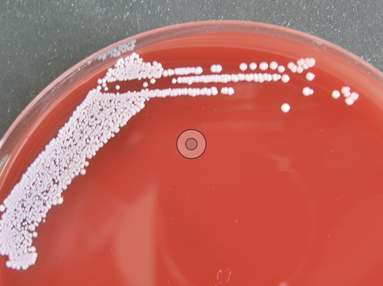 Patrones de sensibilidad de Staphylococcus pseudintermedius aislados de ...